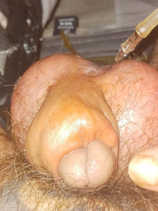 Cbt Burning Cock Head Gland Repeatedly American Gay Amateur Porn Xhamster