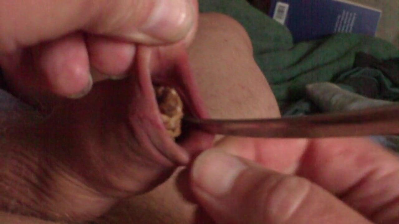 A Spoon And A Pine Cone In Foreskin 3 Minutes Gay Sex Toy Porn