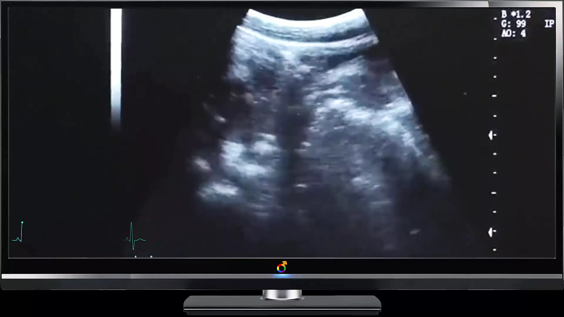 Papi Ultraschall Tiefer Fick Xhamster
