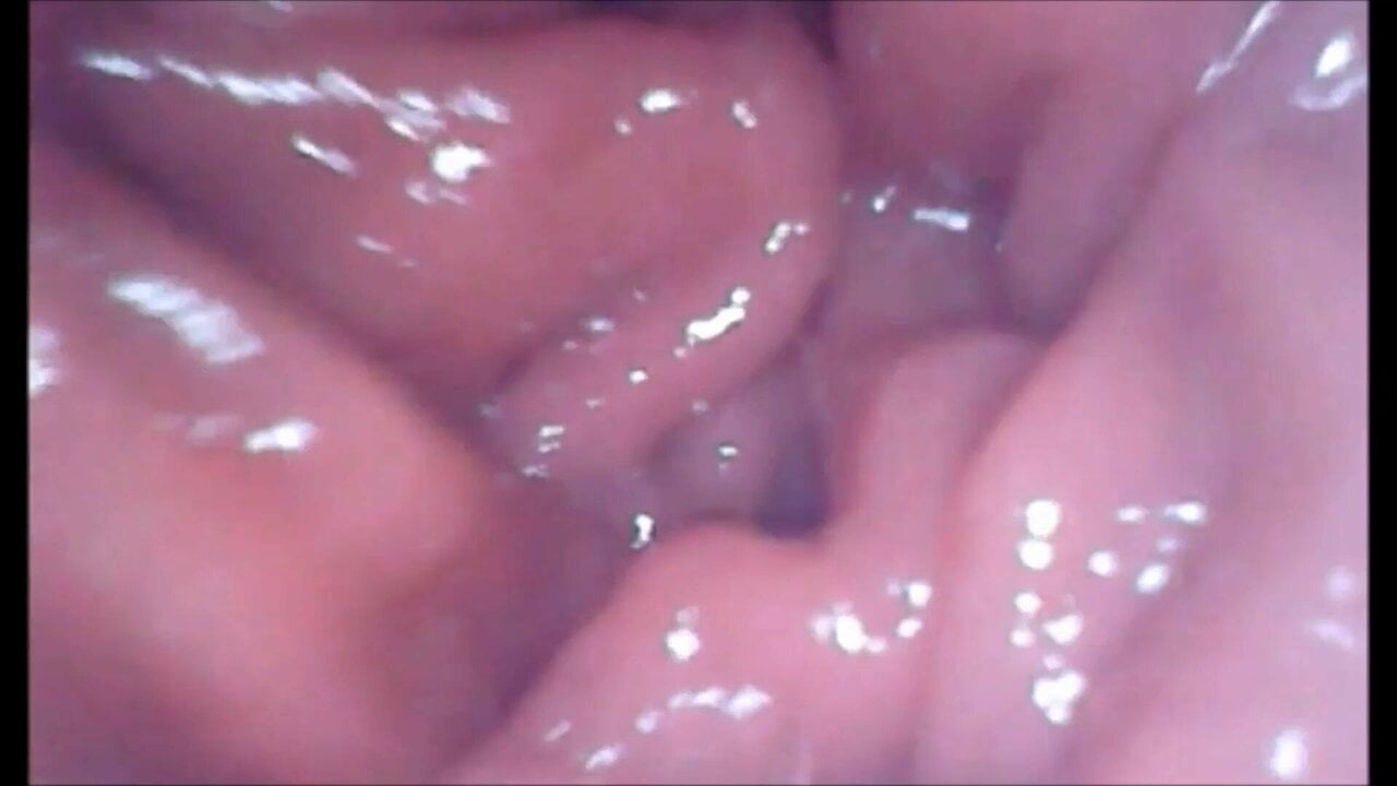 Extreme Close Up Of My Grandpas Wet Loose Hole Gay Daddy Porn Xhamster