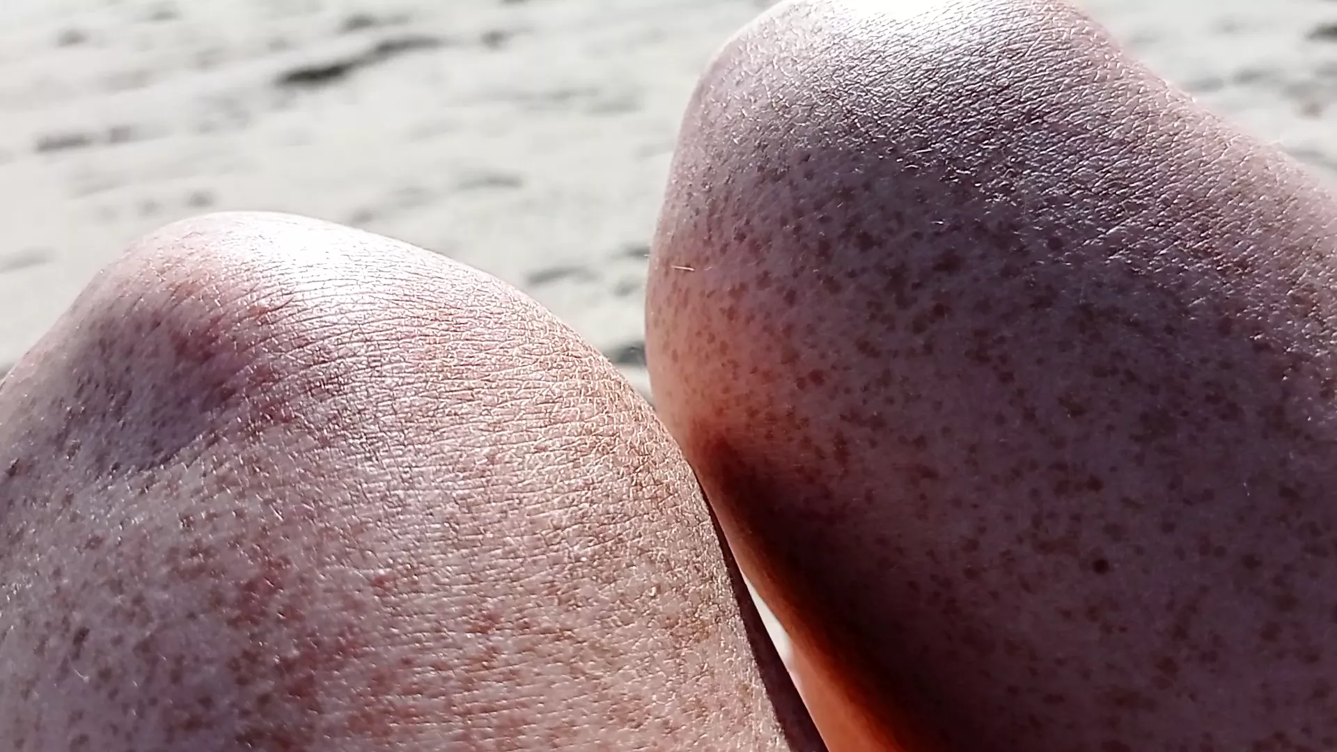 Hairy Pussy 720p Hd Porn Videos Women With Bushes Xhamster 3811