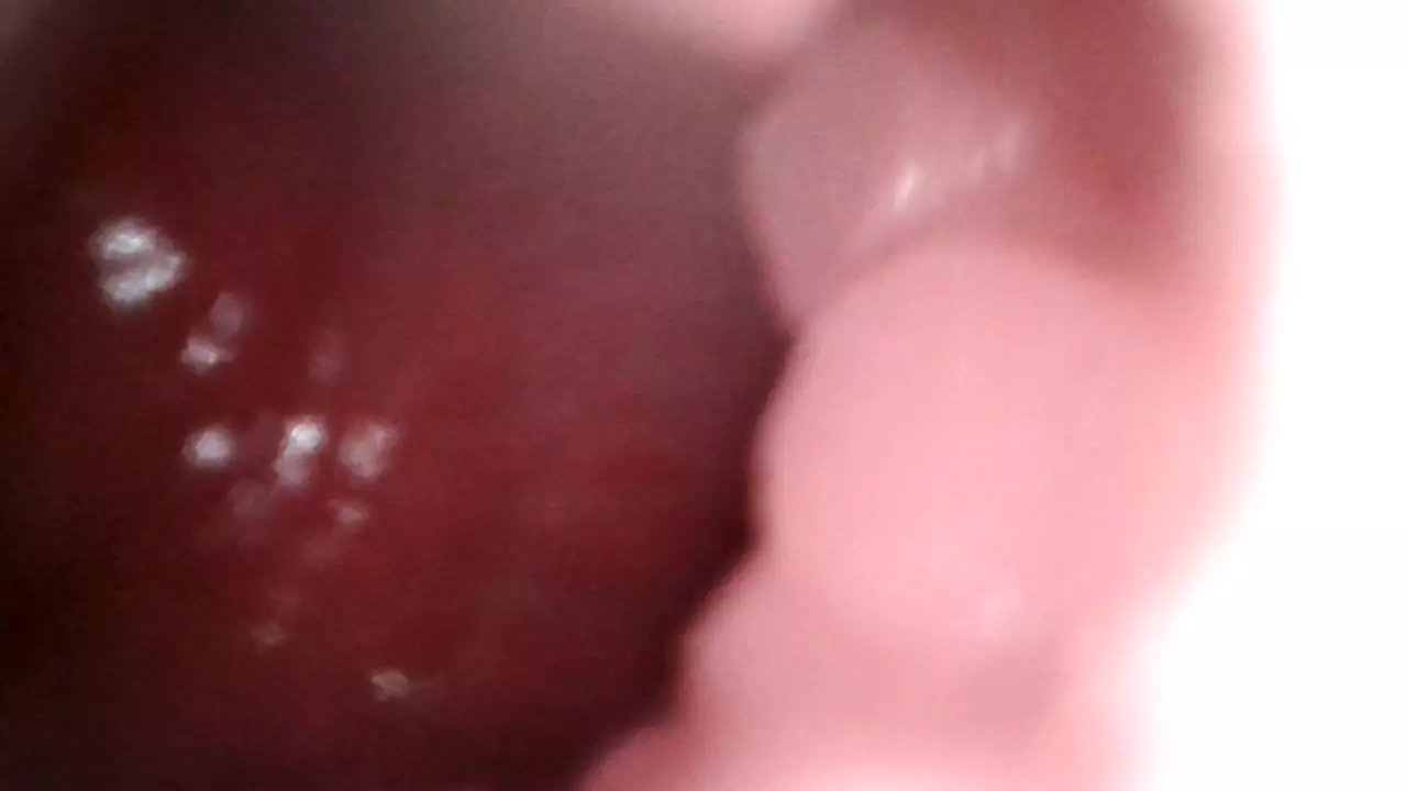Tief In Sich Kommen Xhamster 